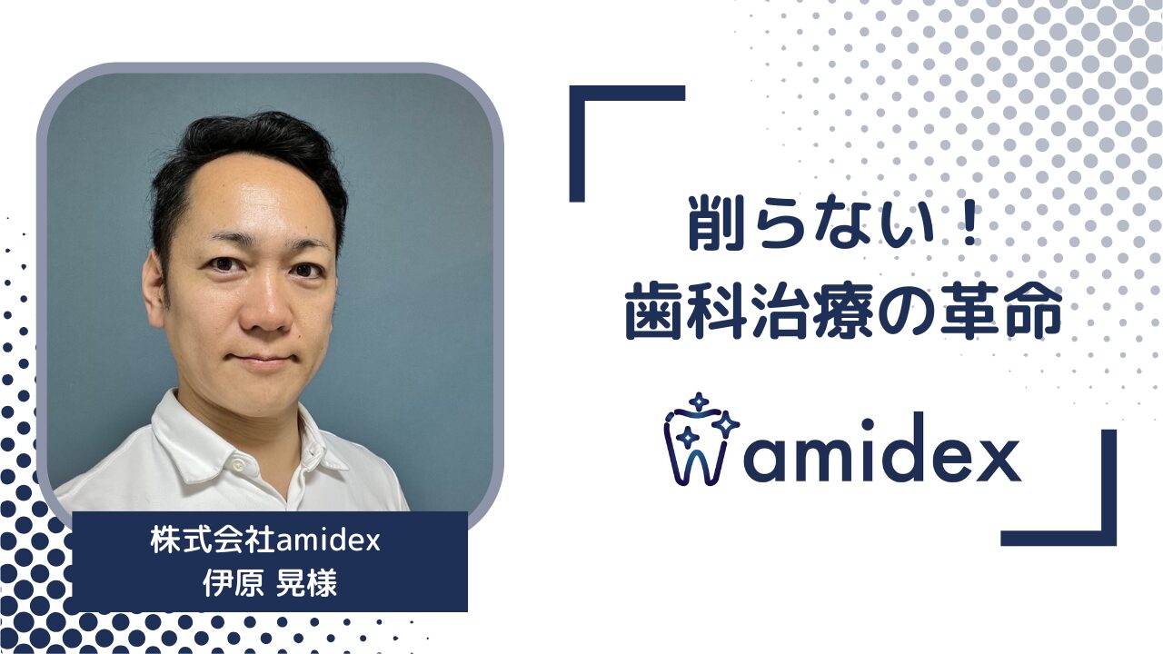 削らない！歯科治療の革命｜株式会社amidex 伊原 晃様 インタビュー – 学生参加型メディア「ビズキャンプラス」